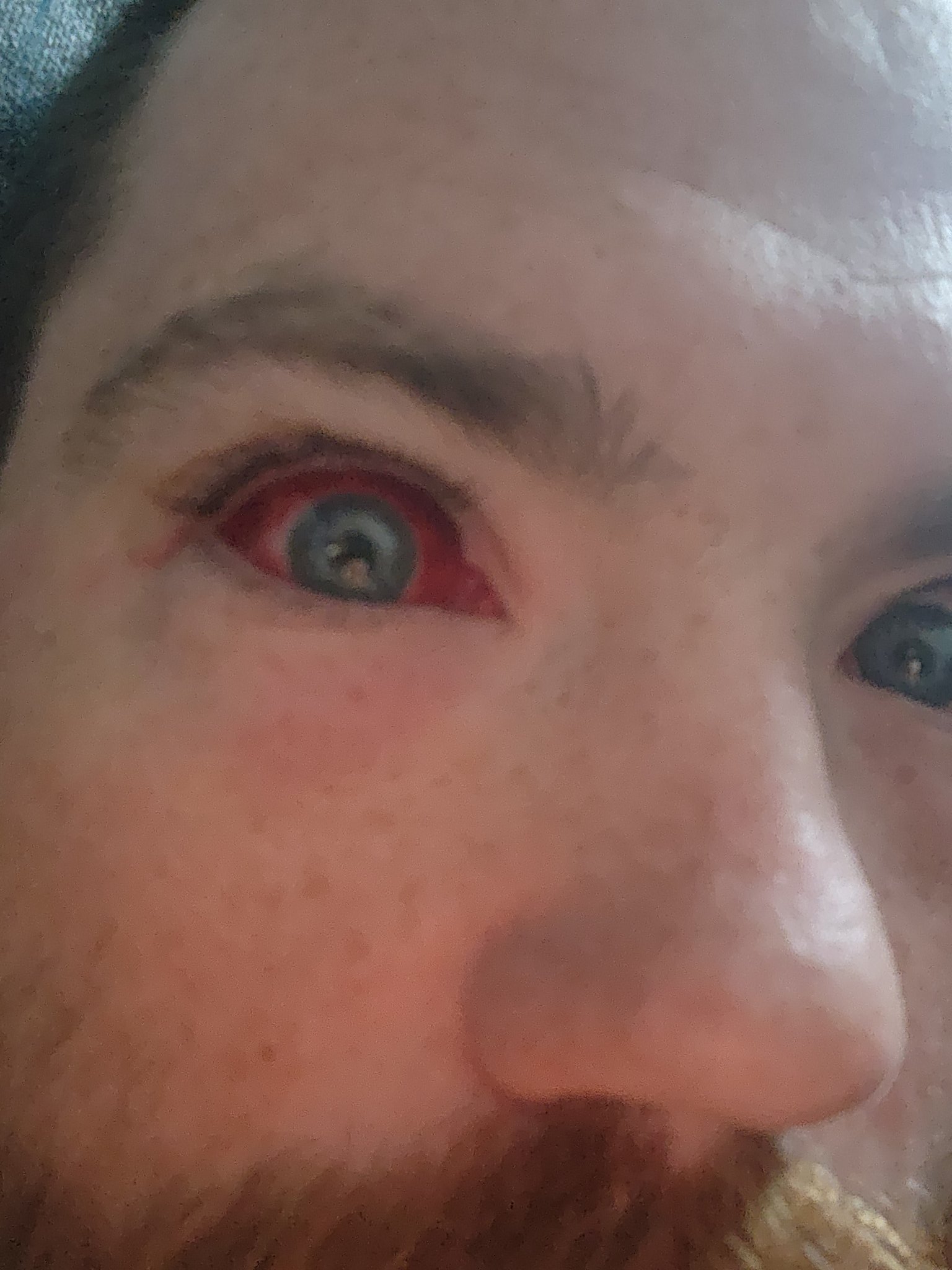 28 Days Later Infected Eyes