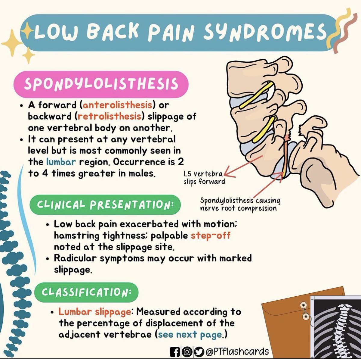 Spondylolysis Underrecognized Cause Of Low Back Pain Examination Of