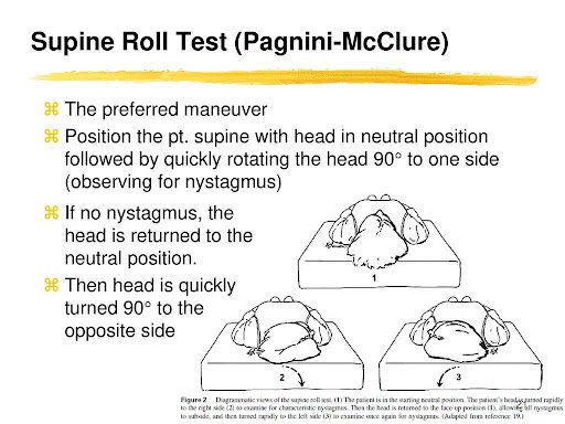 NEUROLOGICAL APPROACH TO DIZZINESS Dizziness is one of the most common ...