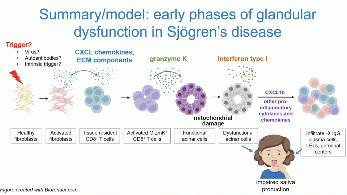 Pathophysiology of Sjögren's syndrome by Frans G.M. Kroese Sjögren's is ...