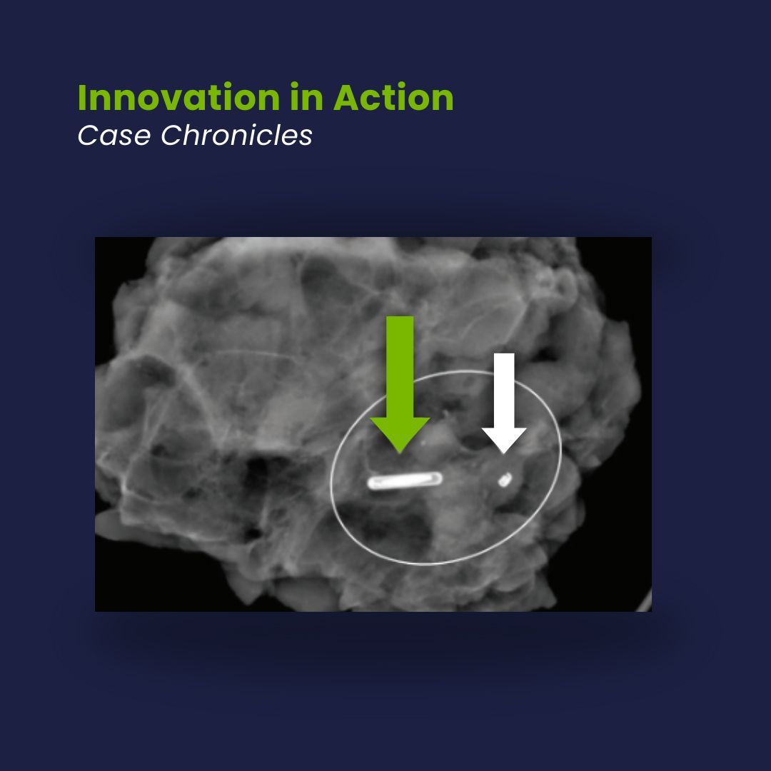 News on In-Site Spatial Intelligence Technology - Elucent Medical