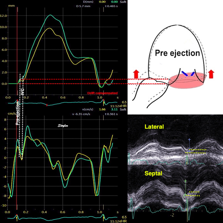 🧵On the Wiggers diagram. It is an illustration of temporal relations of ...