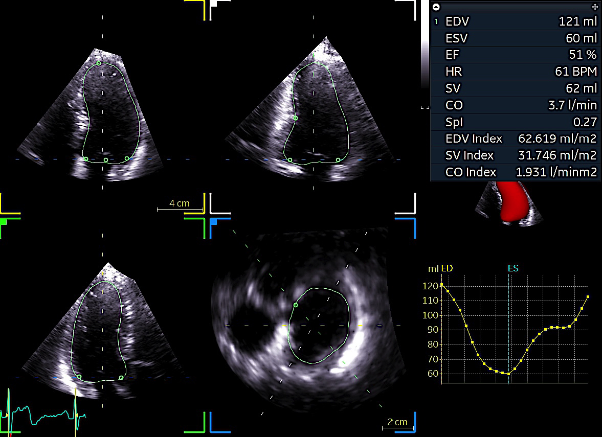 🧵On the Wiggers diagram. It is an illustration of temporal relations of ...