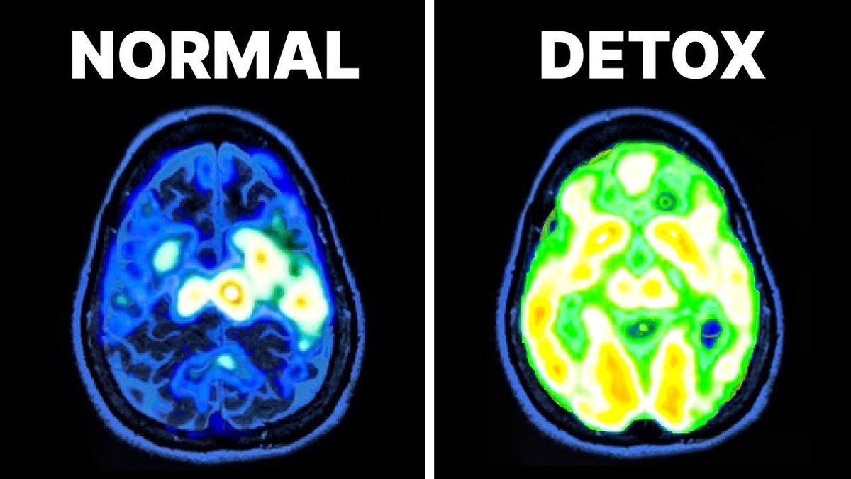 Your mind is your greatest asset. But it's being fried by simulants ...