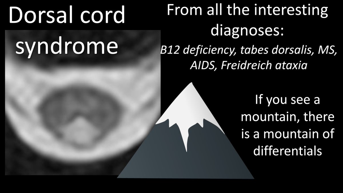 1/”I LOVE spinal cord syndromes!” is a phrase that has NEVER, EVER been ...