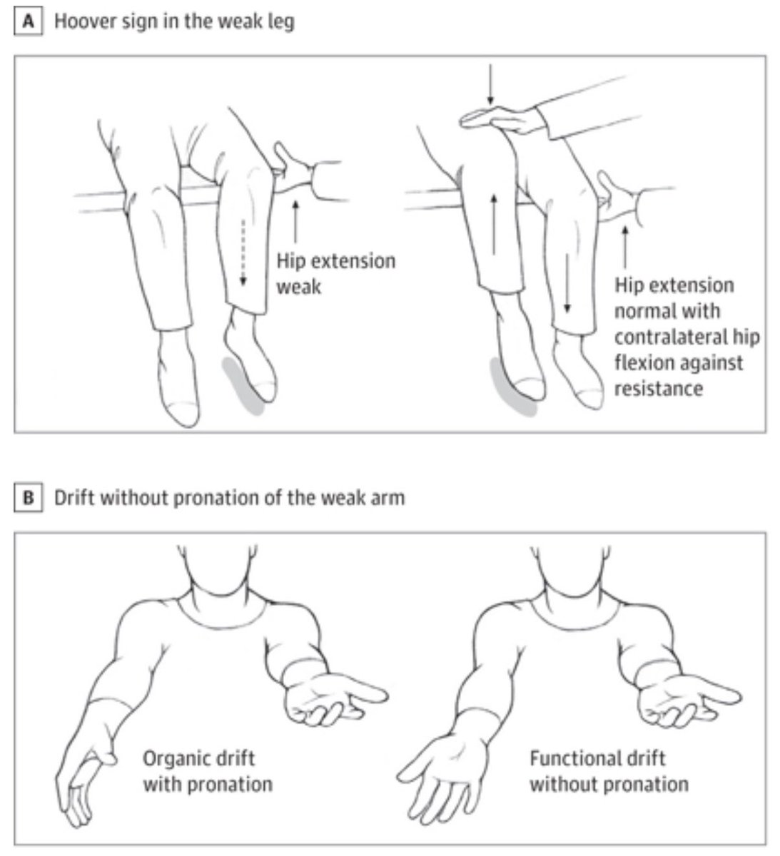 👩🏽‍💻‼️𝘴𝘪𝘨𝘯𝘰𝘴 clínicos🩺 en los que basar el diagnóstico 𝘱𝘰𝘴𝘪𝘵𝘪𝘷𝘰 de los ...
