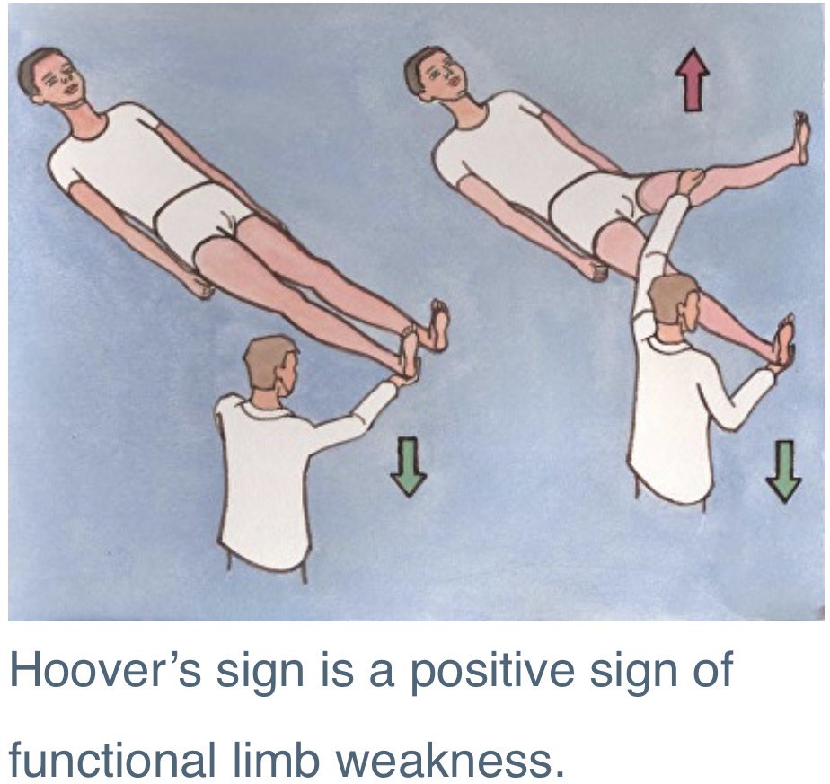 👩🏽‍💻‼️𝘴𝘪𝘨𝘯𝘰𝘴 clínicos🩺 en los que basar el diagnóstico 𝘱𝘰𝘴𝘪𝘵𝘪𝘷𝘰 de los ...