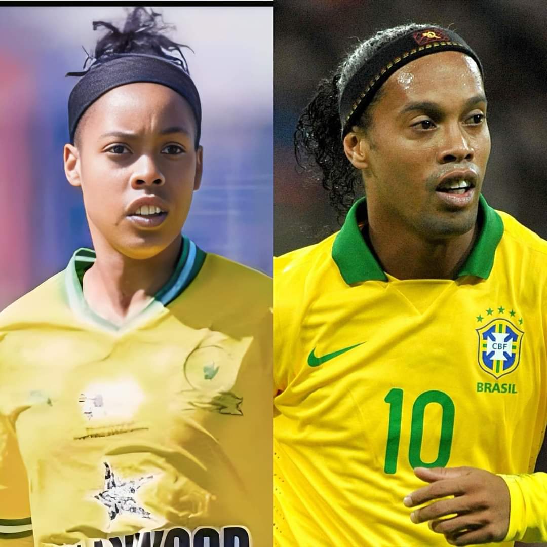 Ronaldinho Teeth Ronaldinho Has Goofy Teeth Fixed In Operation WATCH