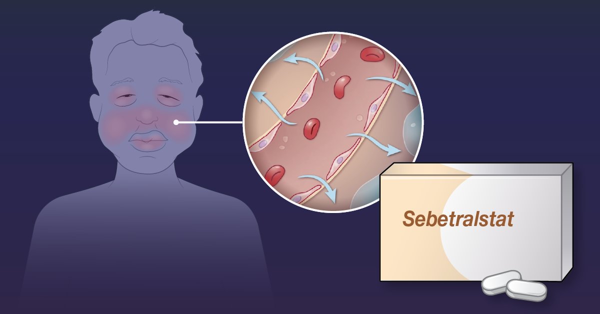 Hereditary Angioedema Hereditary Angioedema | World Allergy