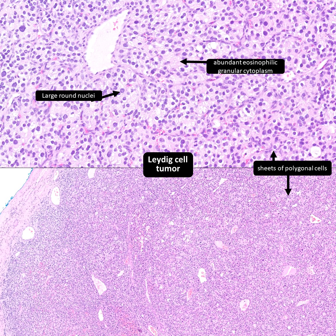 Leydig Cells Histology