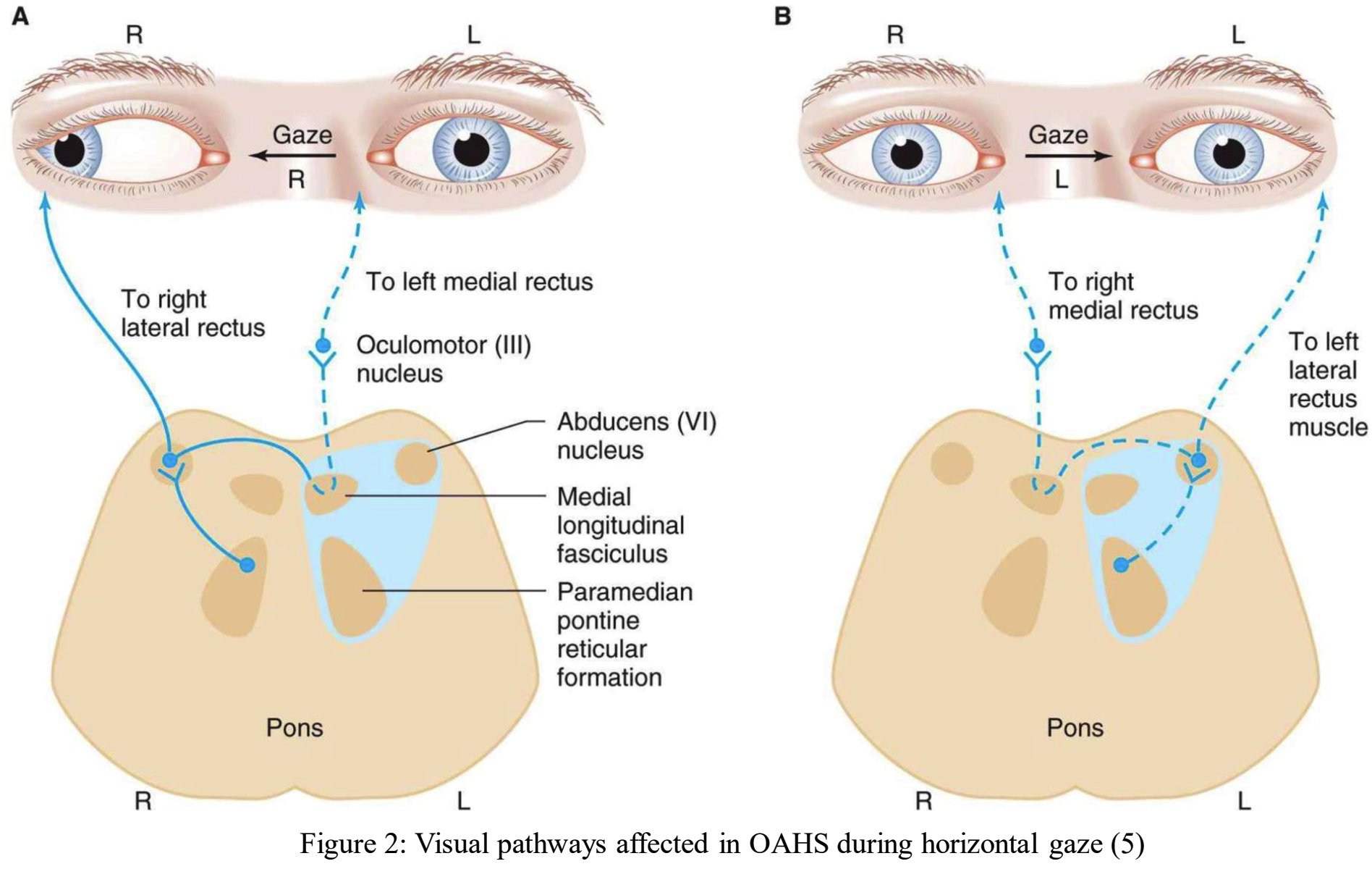 Paramedian Pontine Reticular Formation The Reticular Formation