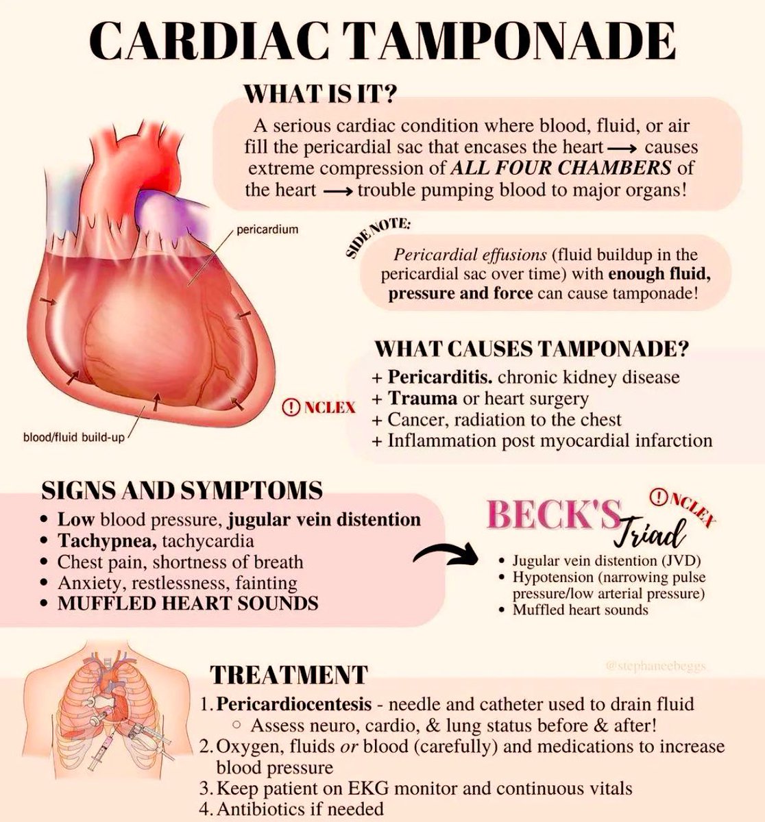 Cardiac Tamponade Symptoms Beck's Triad