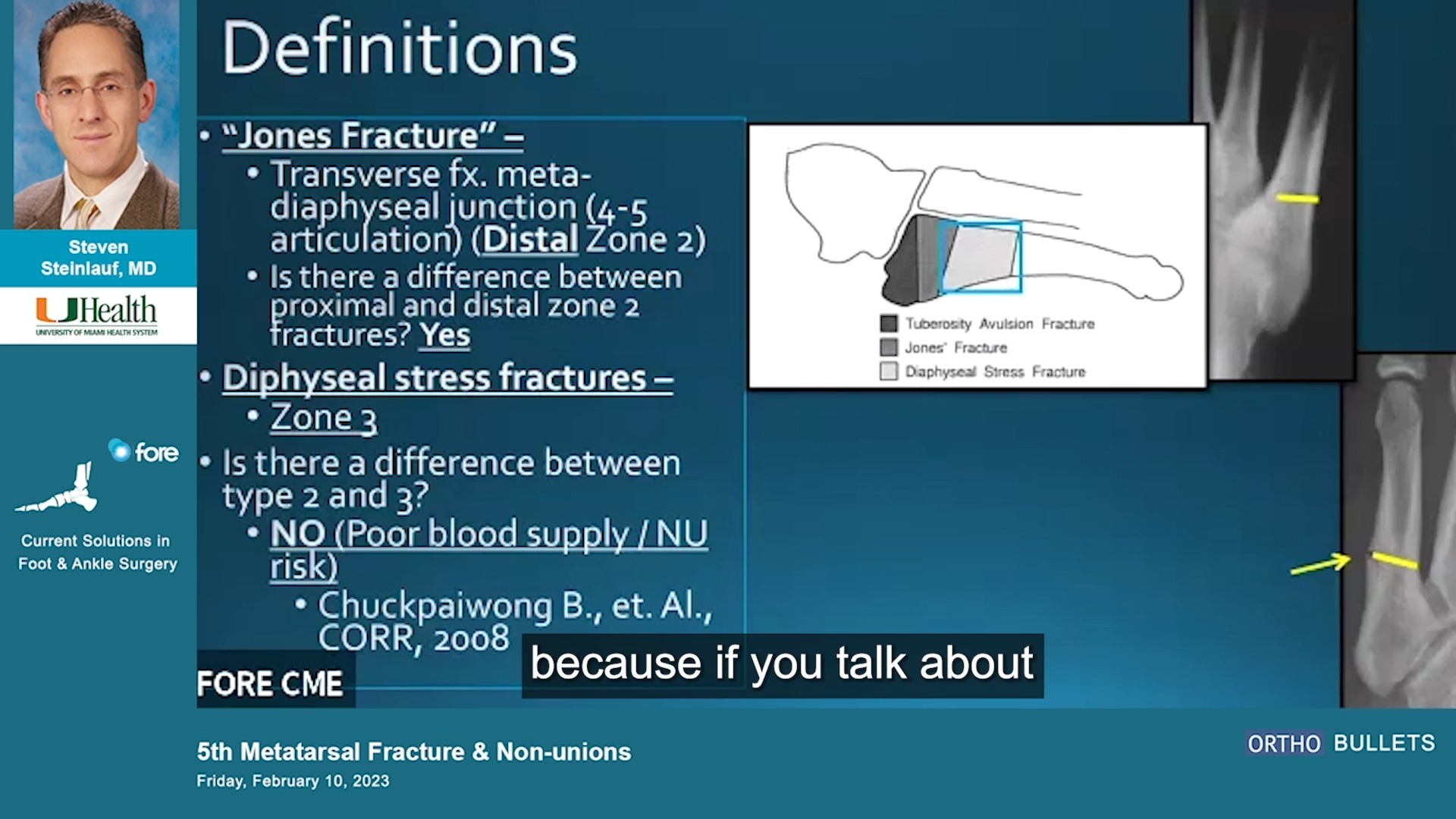 Jones Fracture Orthobullets