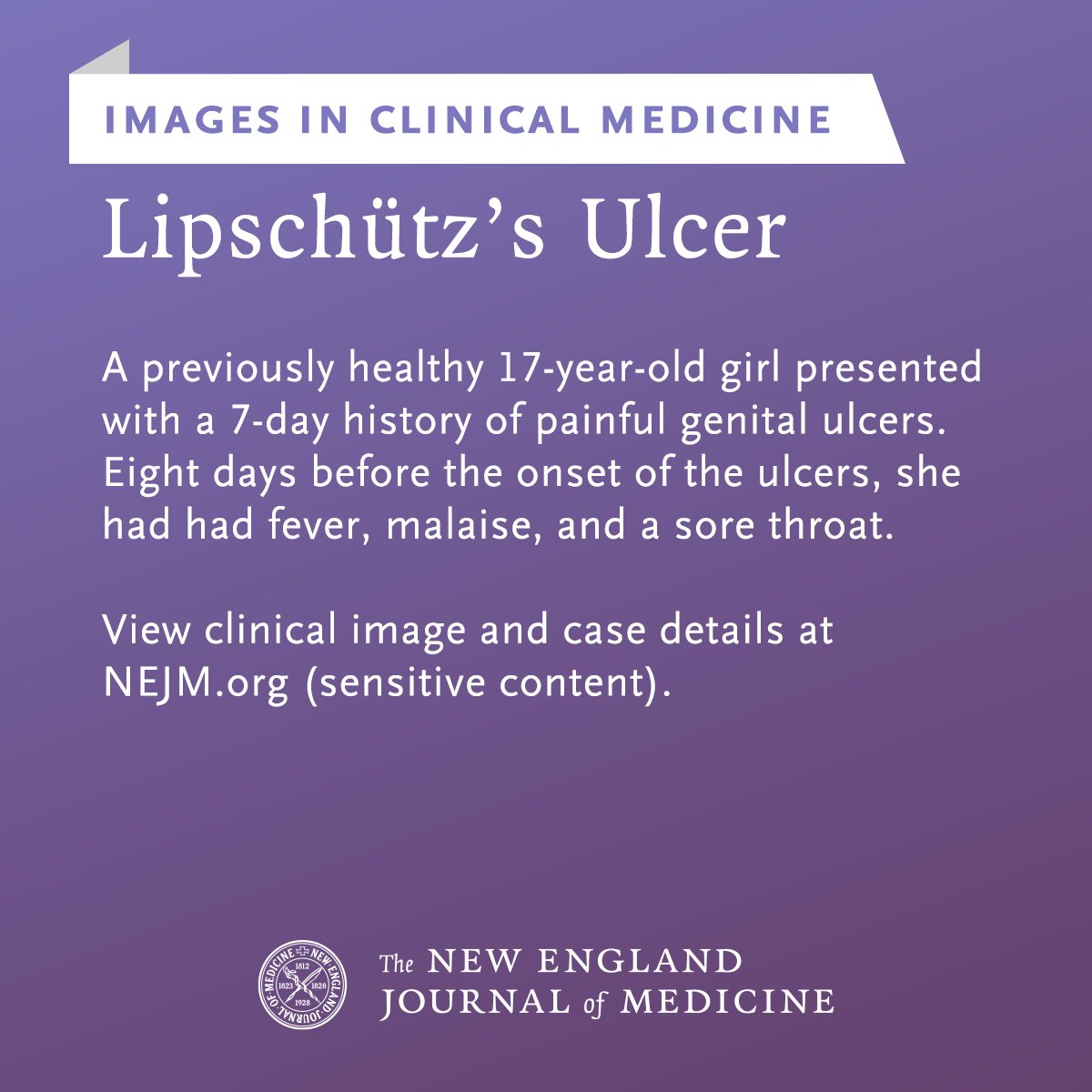 Ulcer Treatment