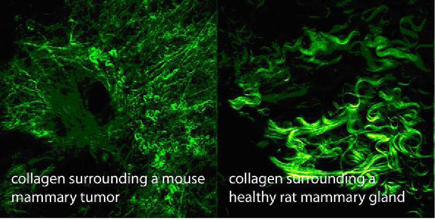 Total collagen content of the body actually INCREASES with aging The ...