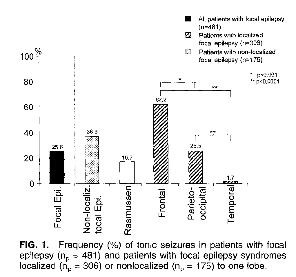 SEIZURE SEMIOLOGY #TWEETORIAL #Epilepsy #Seizure #NeuroX 🧵1/ What is a ...