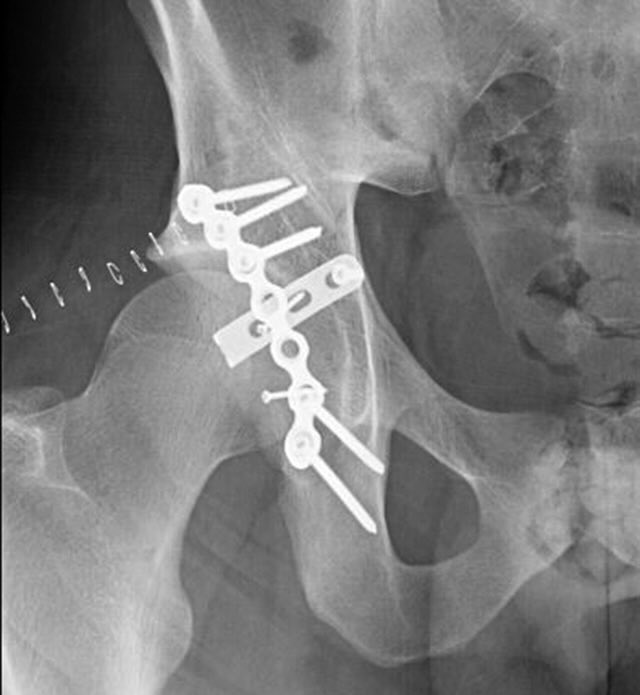 @drharpalselhi @centerofhip The hook name comes from the prongs that ...