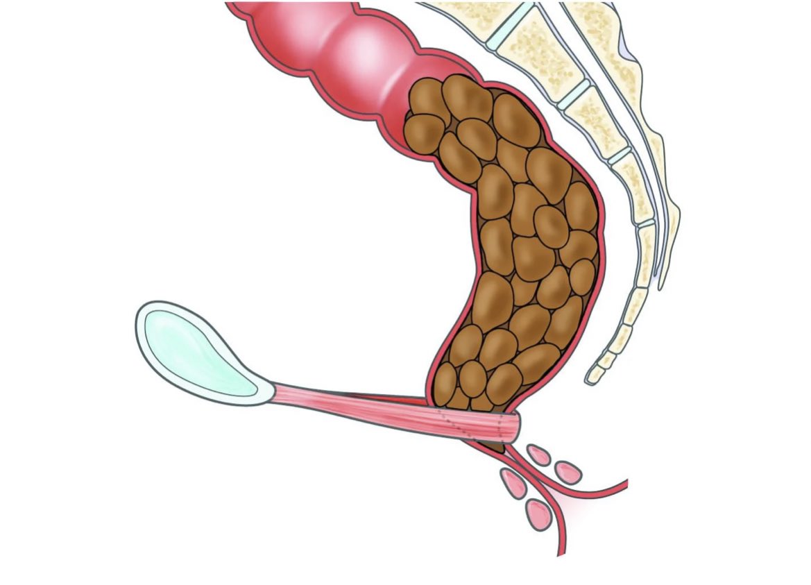 Thread by @zizelle_ on Thread Reader App – Thread Reader App