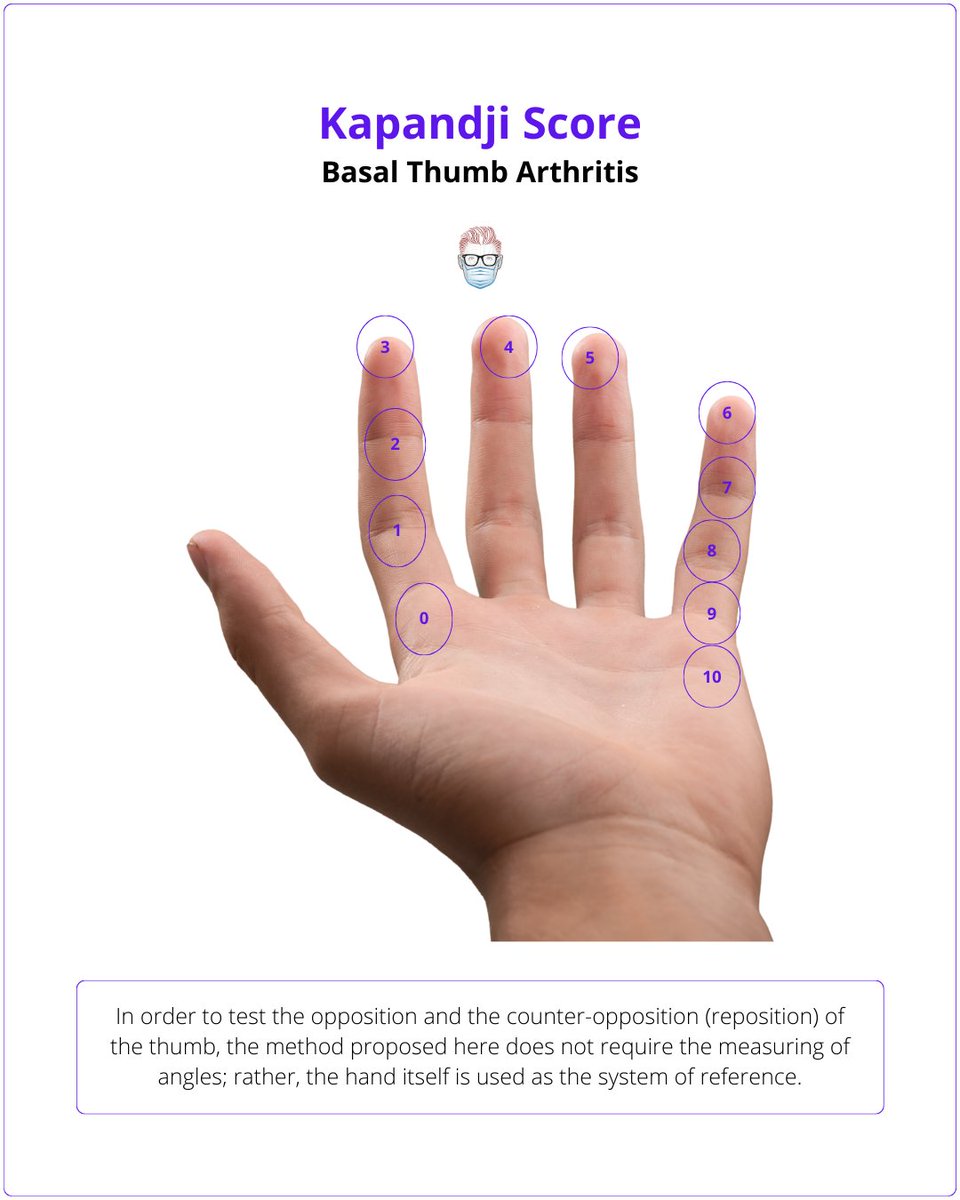 Kapandji Test A Score For Thumb And Hand Dexterity Towards An