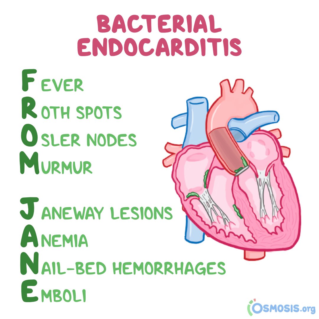 10 CARDIOLOGY mnemonics to help you memorise pearls for board exams and ...