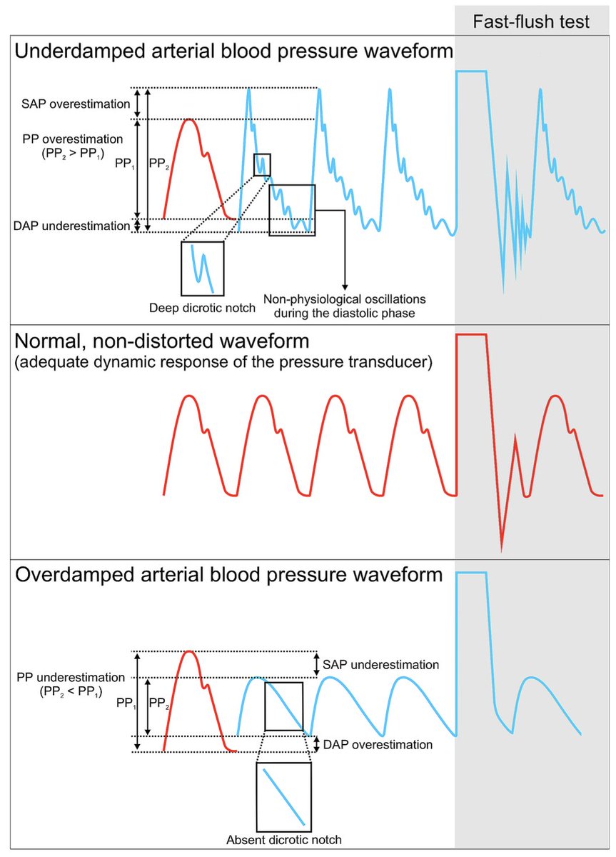 This is the weekly refresher on basic hemodynamic monitoring ...
