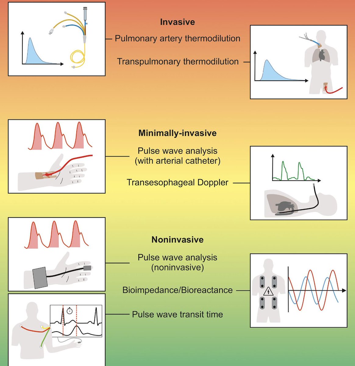 This is the weekly refresher on basic hemodynamic monitoring ...