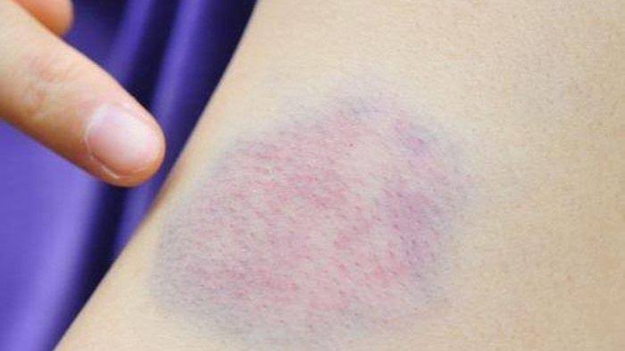 Thread by @afrkml on Thread Reader App – Thread Reader App