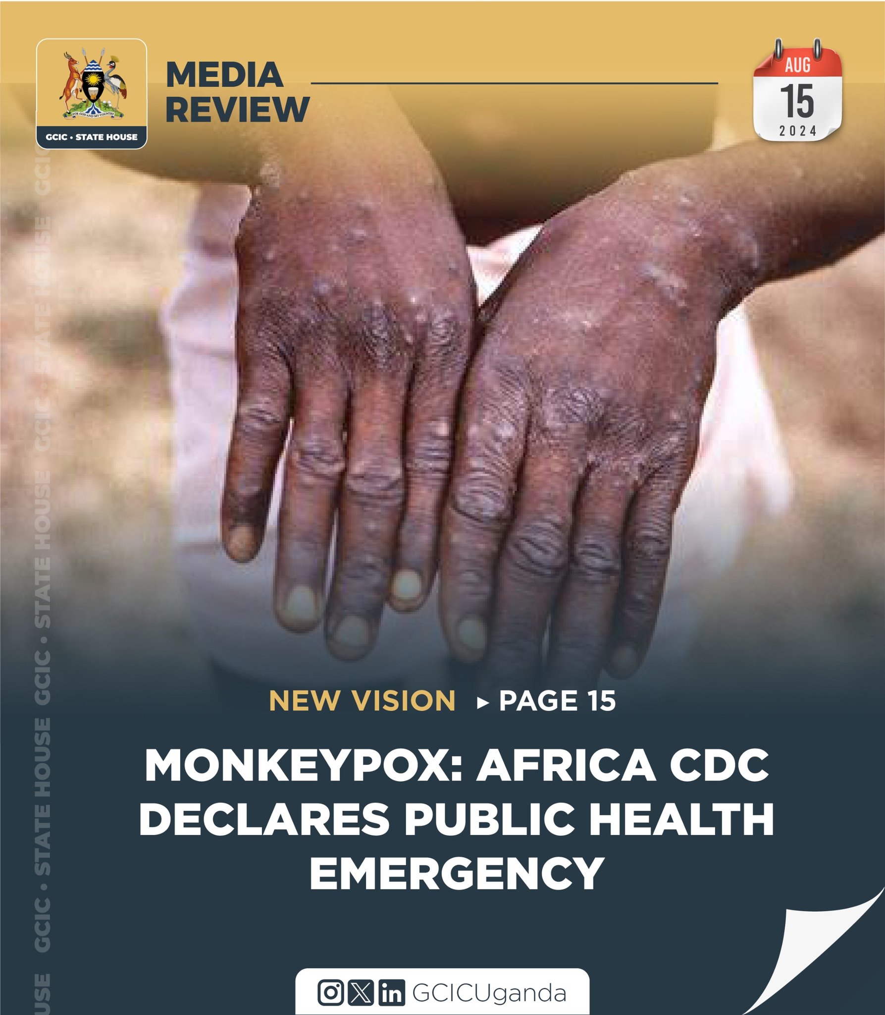 Cdc Monkeypox TPoxx Antiviral Should Only Be Given To High Risk