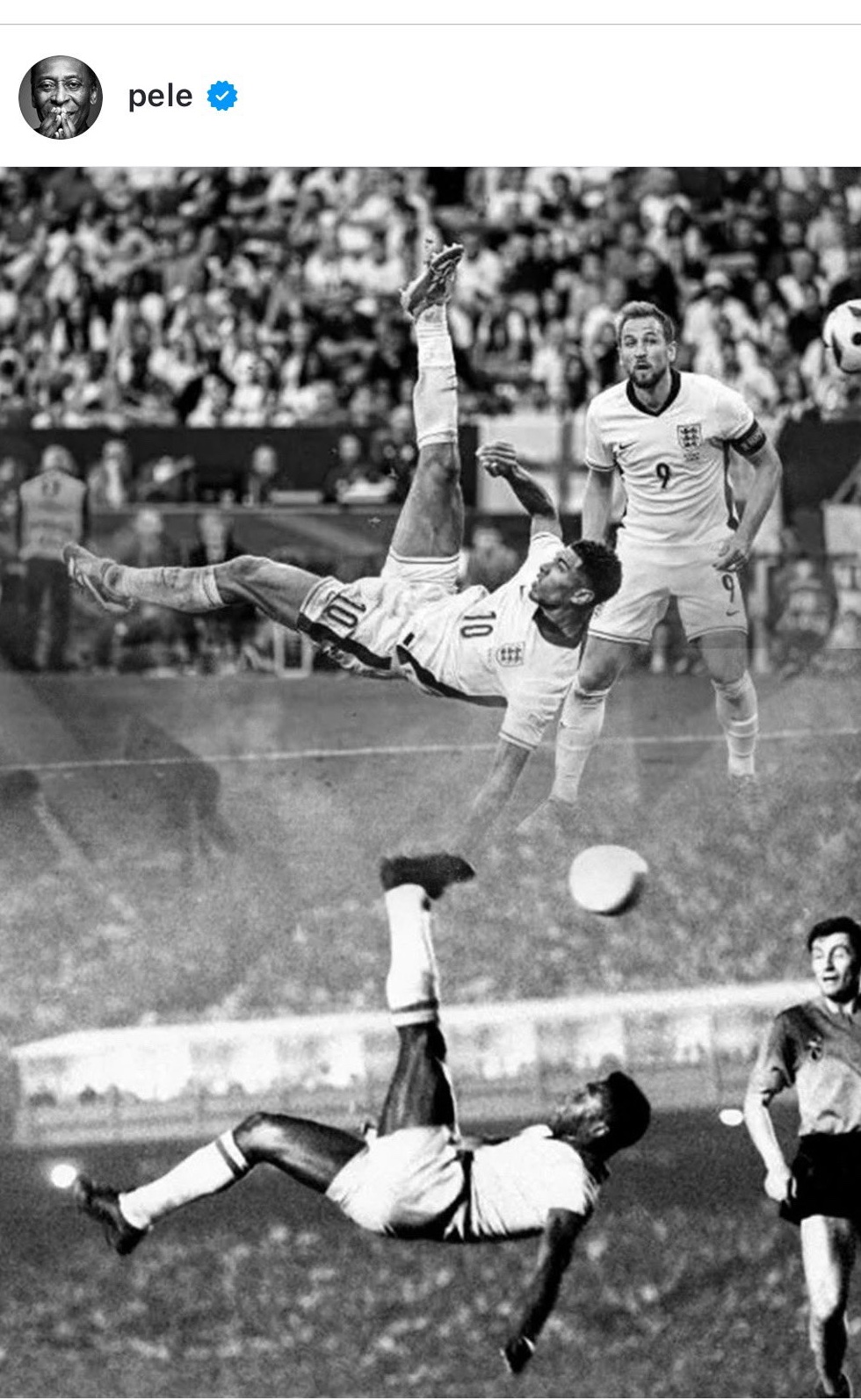 Pele Bicycle Kick Pelé's Football Journey: A Look At The Teams He