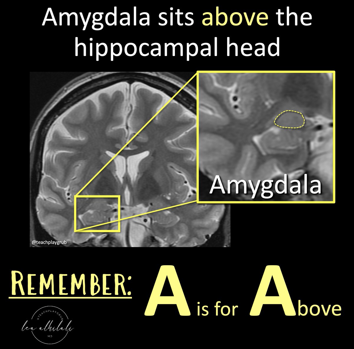 1/Is your understanding of medial temporal anatomy, well, temporary? If ...