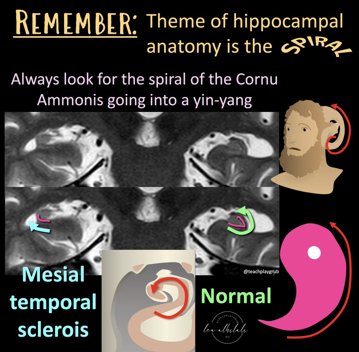 1/Is your understanding of medial temporal anatomy, well, temporary? If ...