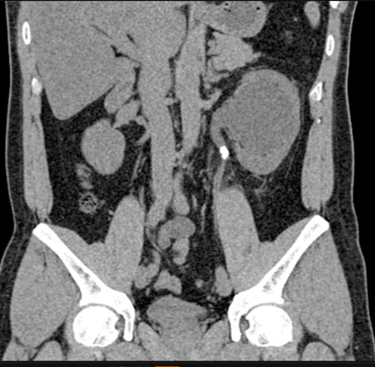 (1/x) We often talk about source control in sepsis, but what does this ...