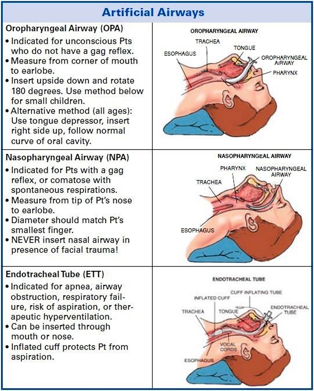 Artificial Airway