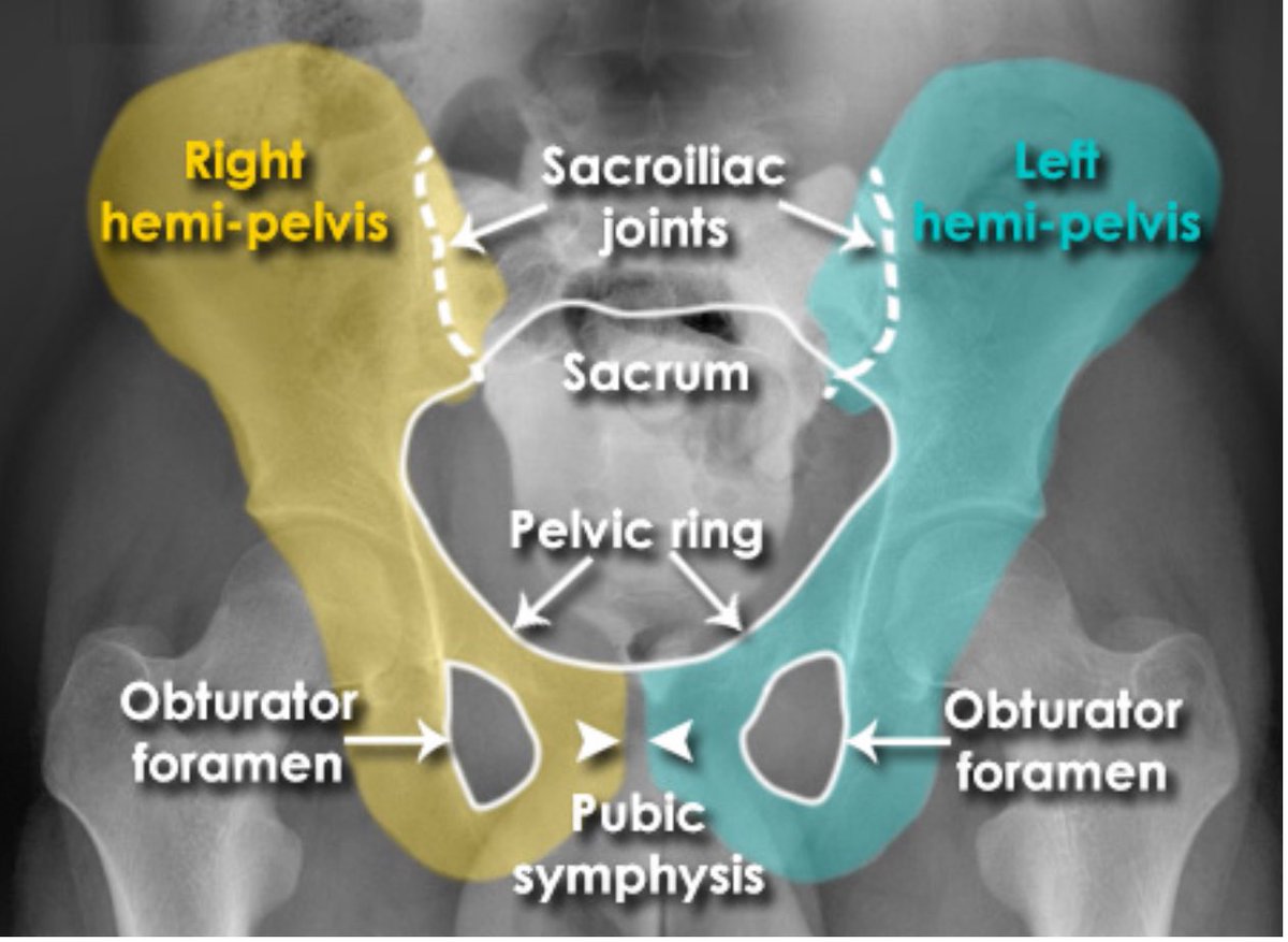 Pelvis anatomy - Normal AP Credits : Radiologymasterclass - Thread from ...