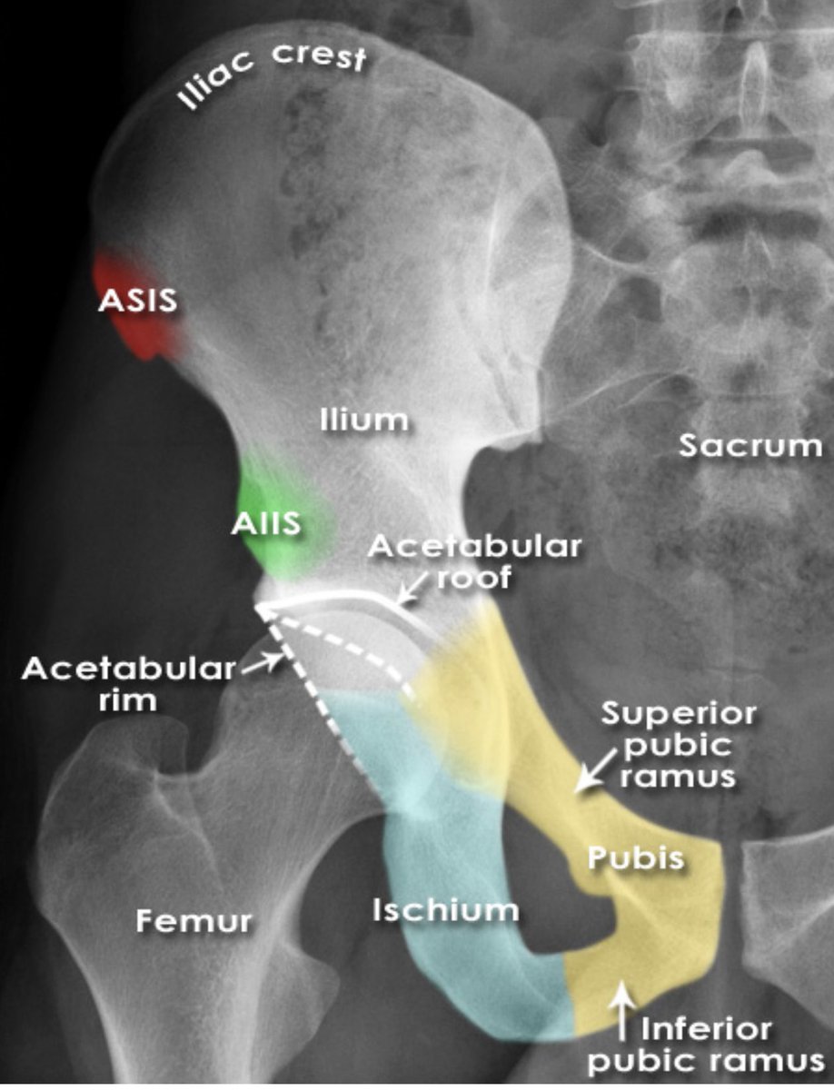 Pelvis anatomy - Normal AP Credits : Radiologymasterclass - Thread from ...