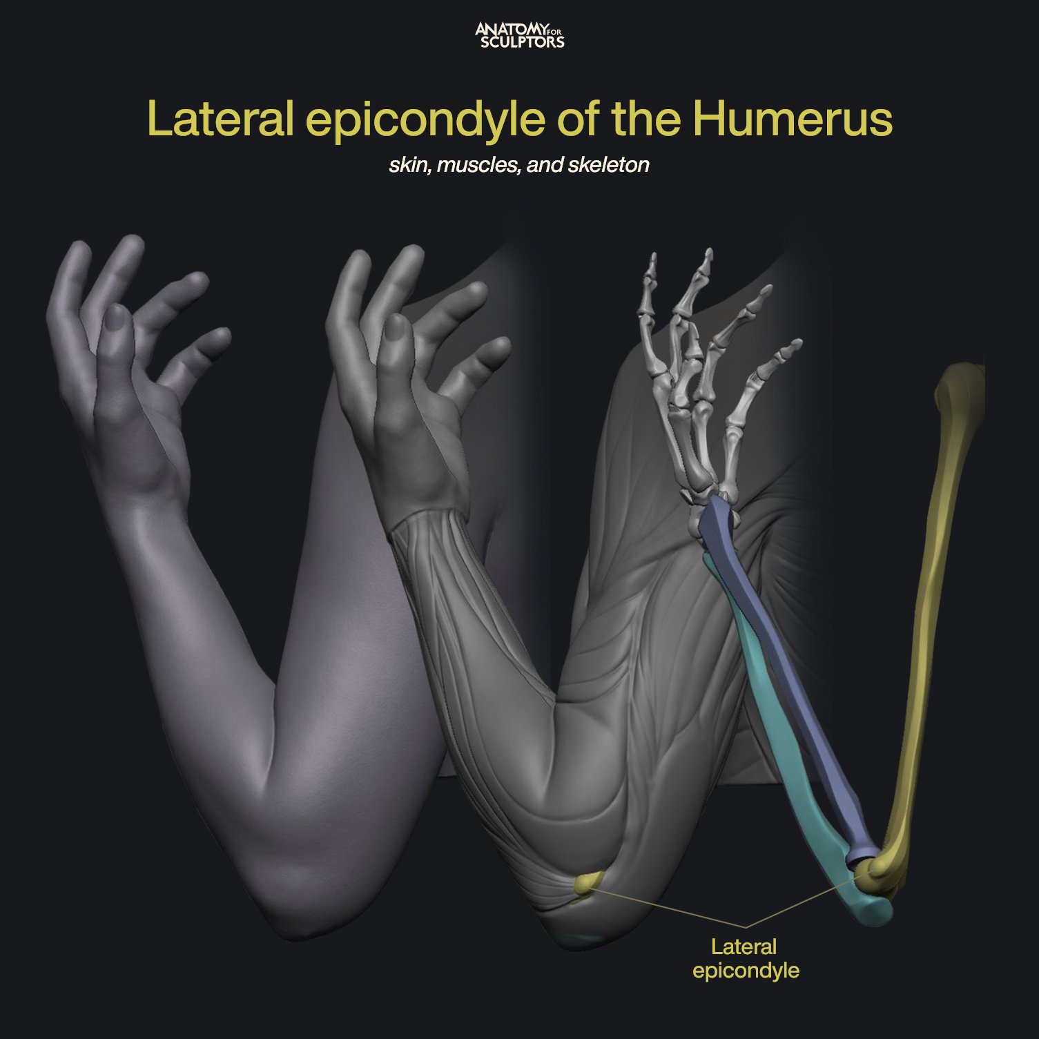 Epicondyle Humerus Lateral Approach To The Cat Distal Humerus