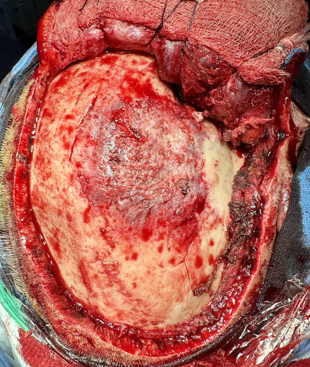 Interesting case! 44-year-old female, with headaches What is your ...