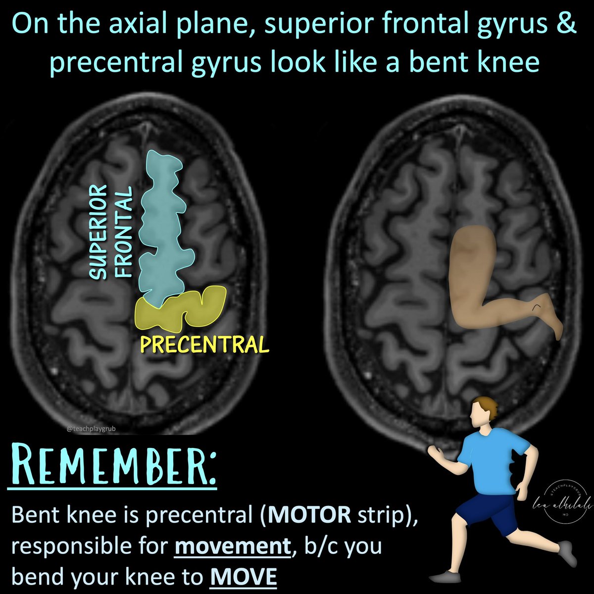 1/Nothing is more CENTRAL to reading an MRI than finding the CENTRAL ...