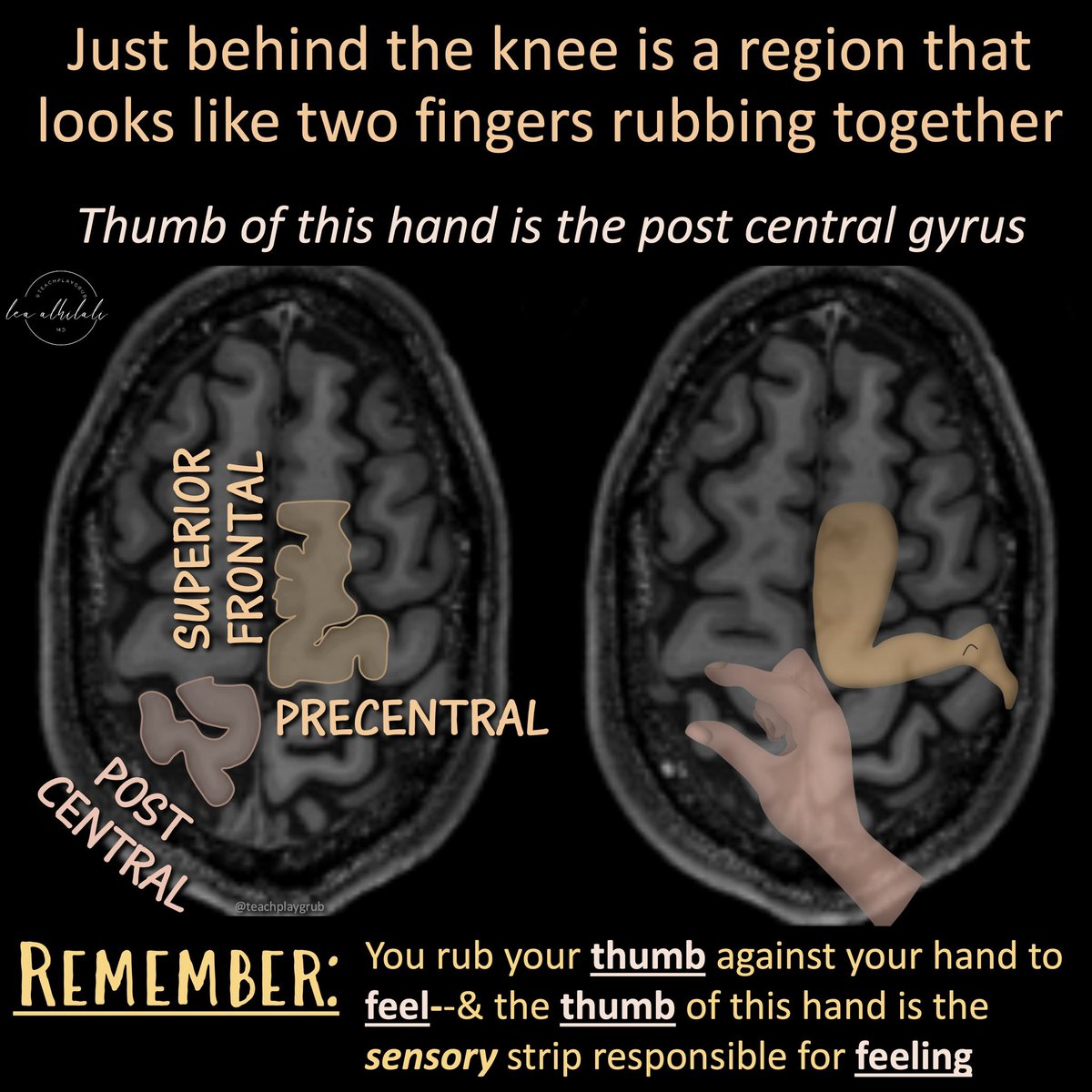1/Nothing is more CENTRAL to reading an MRI than finding the CENTRAL ...