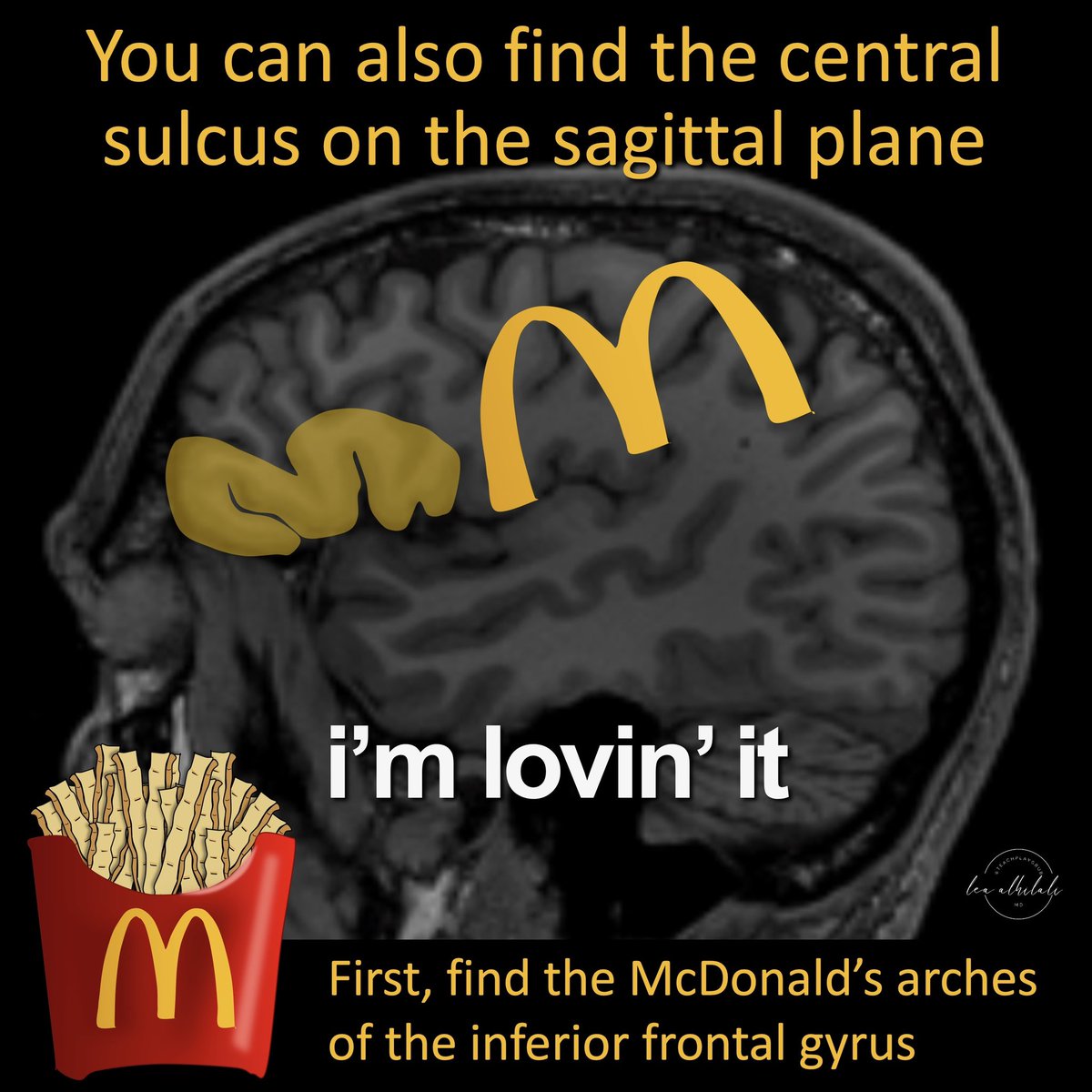 1/Nothing is more CENTRAL to reading an MRI than finding the CENTRAL ...
