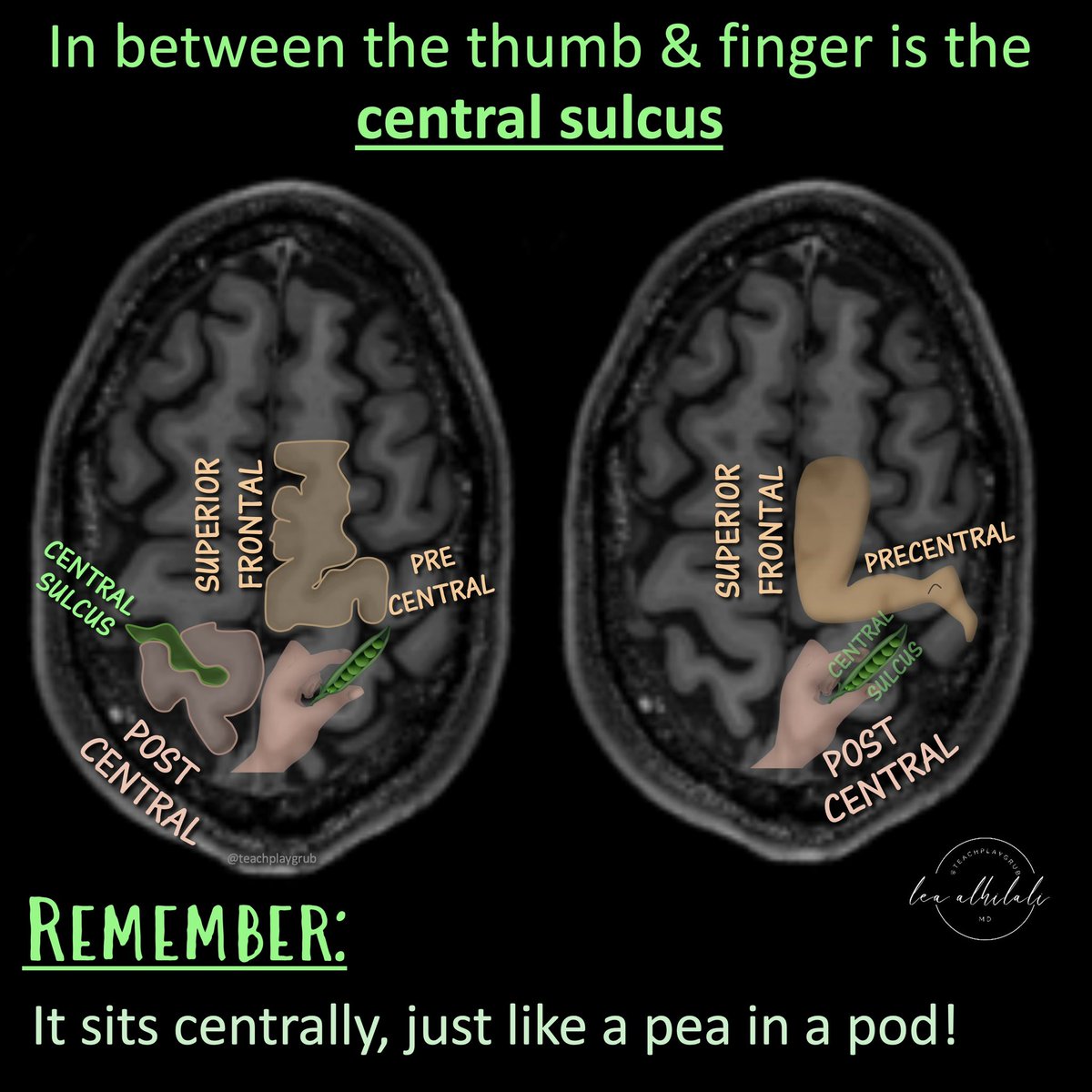 1/Nothing is more CENTRAL to reading an MRI than finding the CENTRAL ...