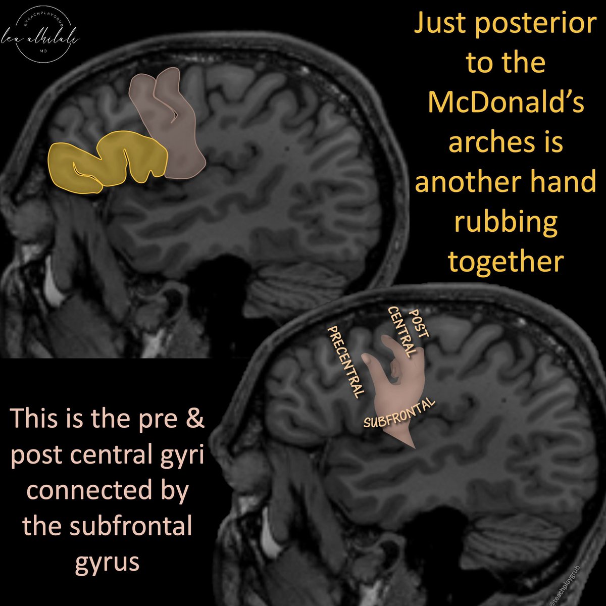 1/Nothing is more CENTRAL to reading an MRI than finding the CENTRAL ...