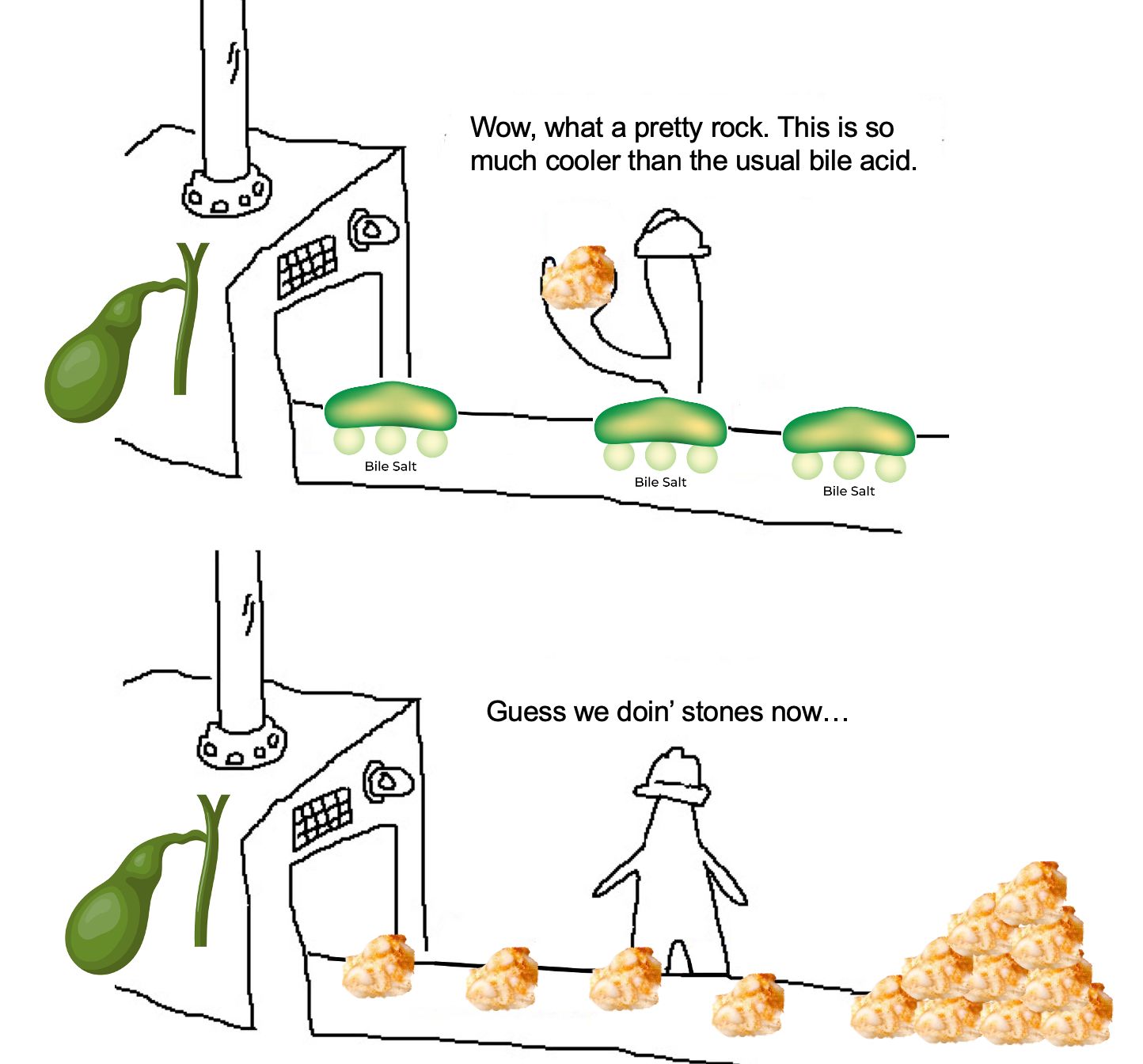 Gallstone Memes Gall Bladder Cartoons And Comics Funny Pictures From