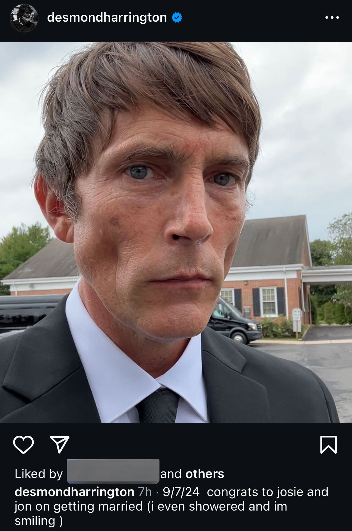 Desmond Harrington Plastic Surgery