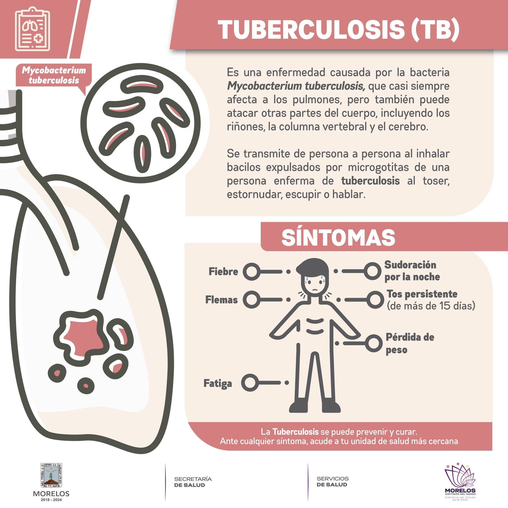 Tos Con Sangre Tuberculosis