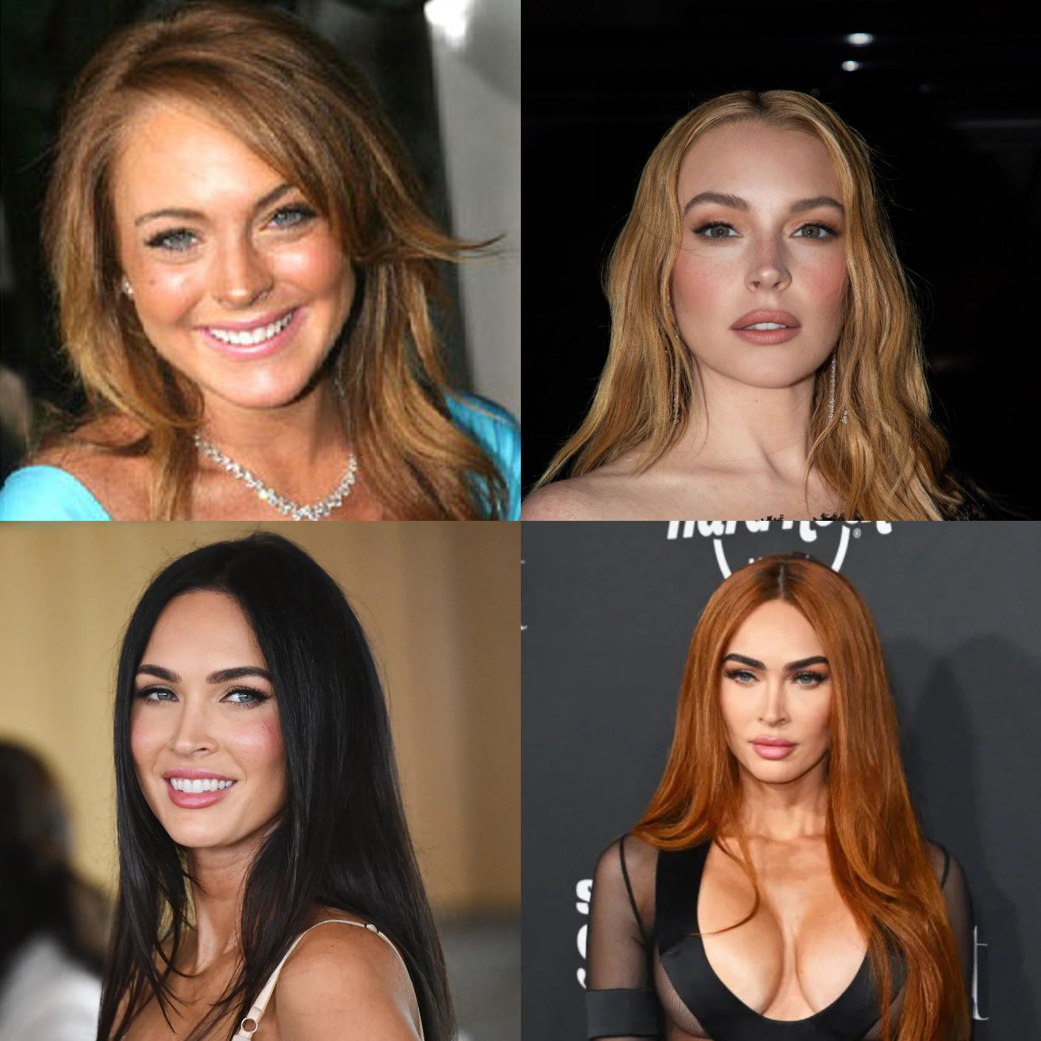 Lindsay Lohan 2024 Plastic Surgery