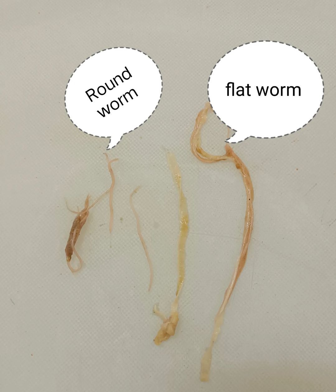 Parasitic Roundworms In Humans