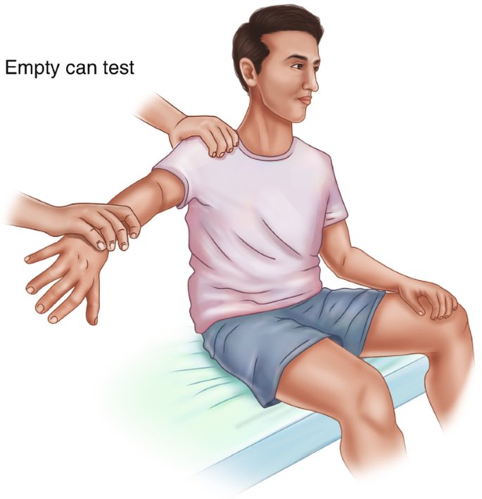 Empty Can Test Aspetar Sports Medicine Journal Musculoskeletal