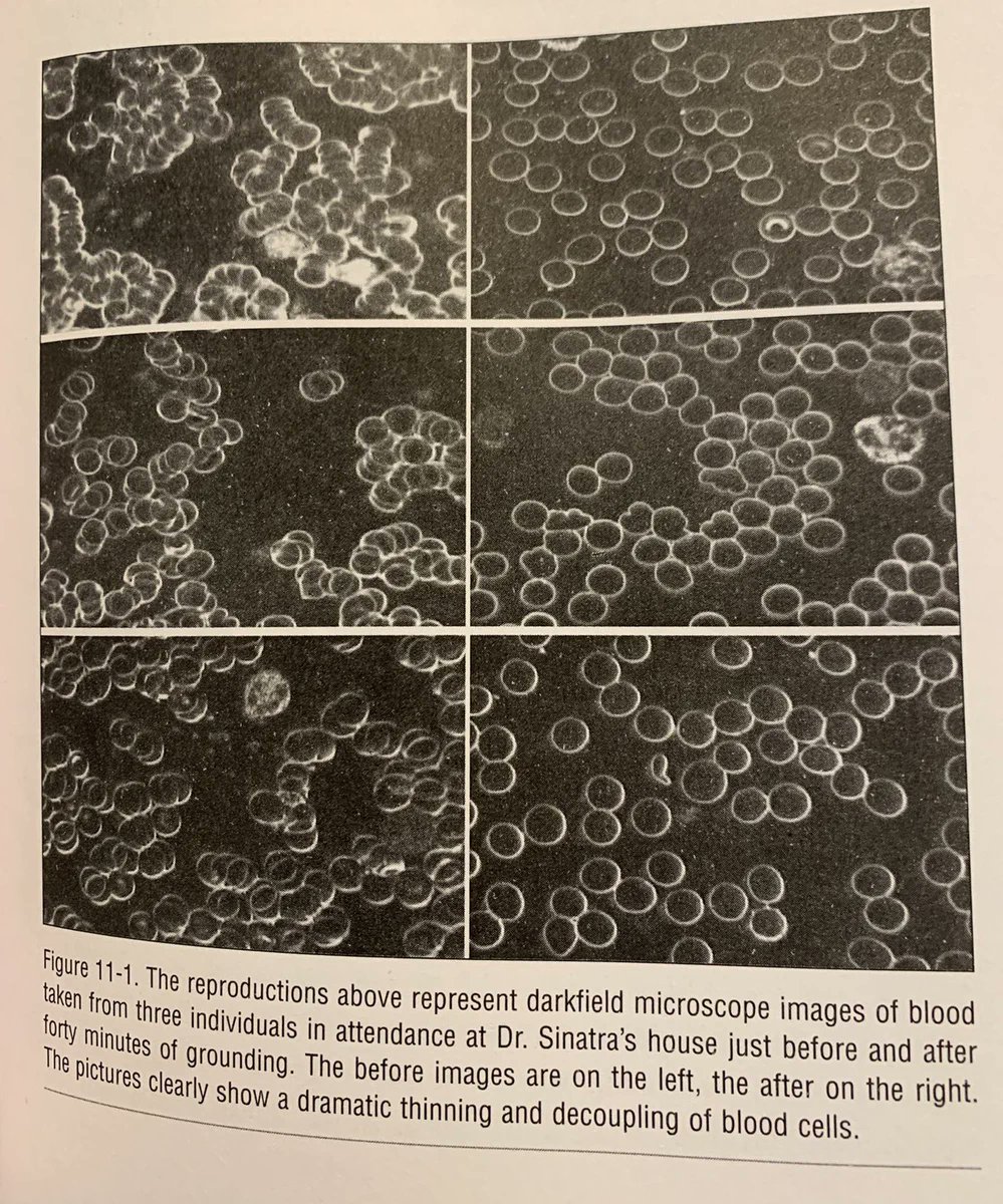 Grounding Thread Skin contact with the earth has shown to decrease ...