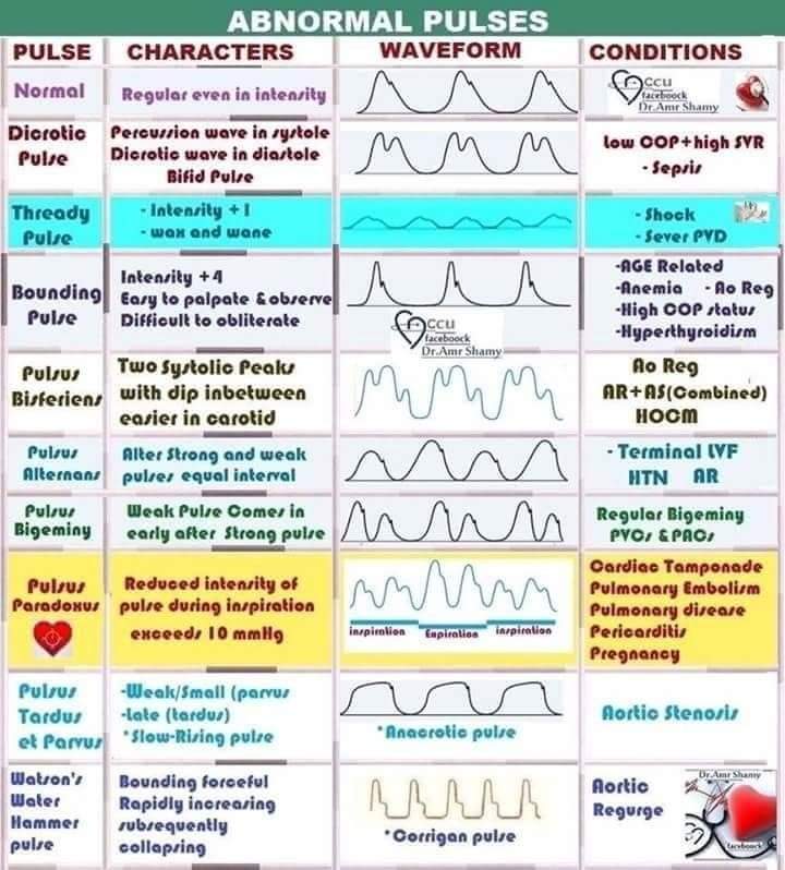 🔴⏬Abnormal pulses & Most likely causes⤵️🔹 #Cardiologyexplained #FOAMed ...